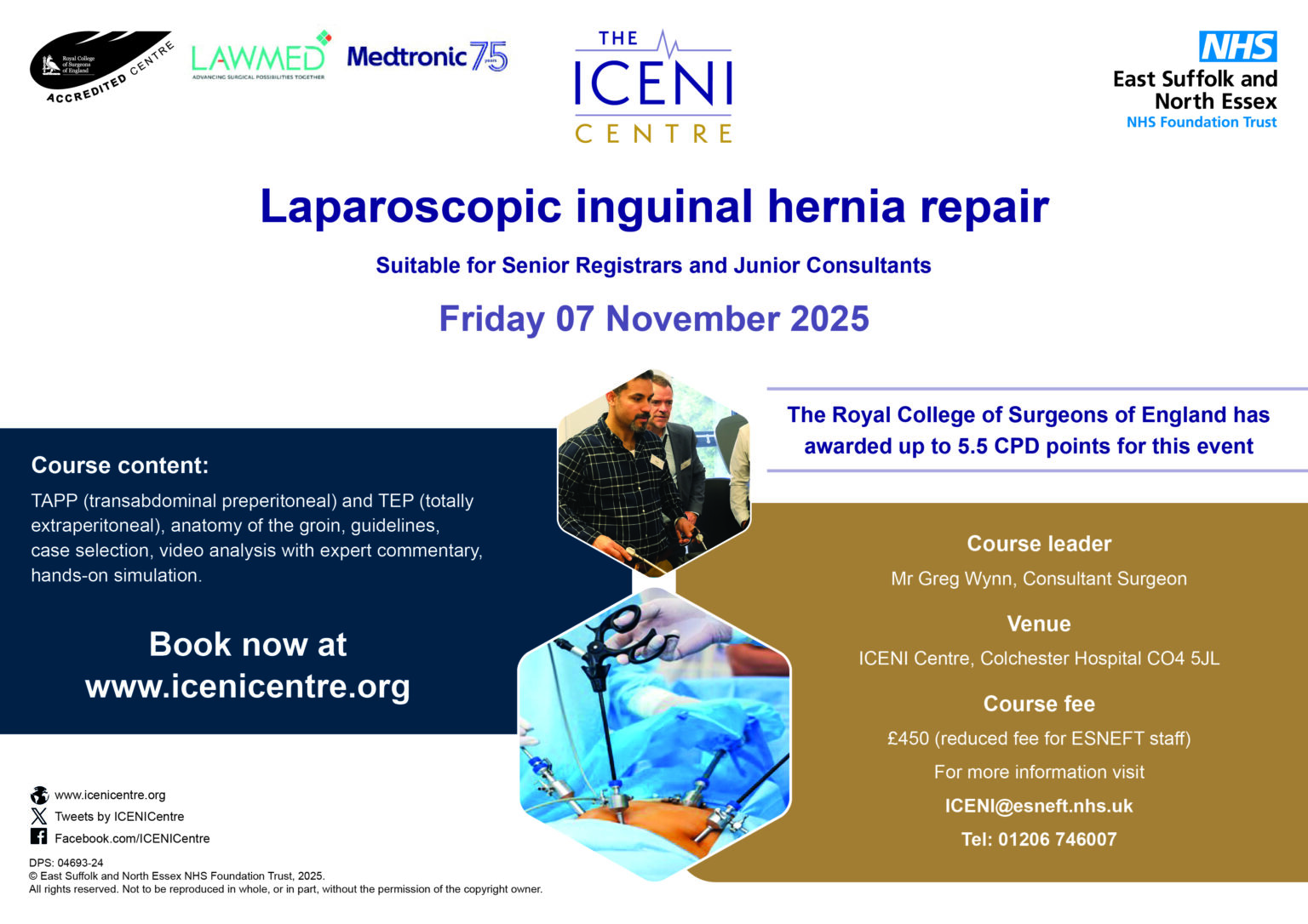 Laparoscopic Inguinal Hernia Repair course - 7th November 2025 - ALSGBI
